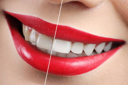 5 Ways General And Cosmetic Dentistry Work Together For A Complete ...